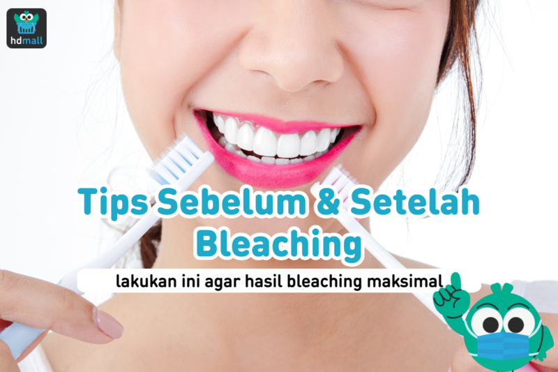 Tips Sebelum dan Sesudah Bleaching Gigi agar Gigi Putih Maksimal | HDmall